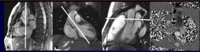 Core Imaging Protocol - Cardiac MRI